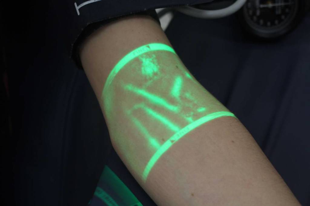 Vein Viewing Technology | Tech and Facts